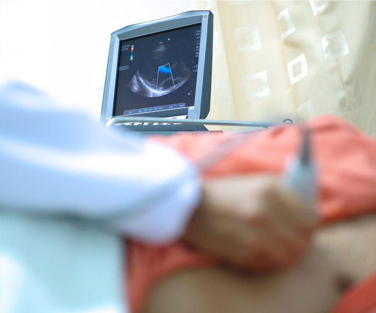 Echocardiogram – Mthatha Cardiologist